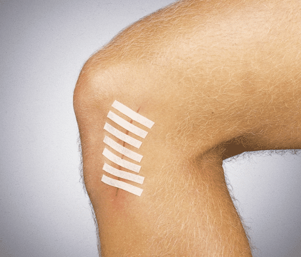 Suture strip plus hechtstrip 6mmx102mm per 50x6st. per 4 doosjes kopen ...